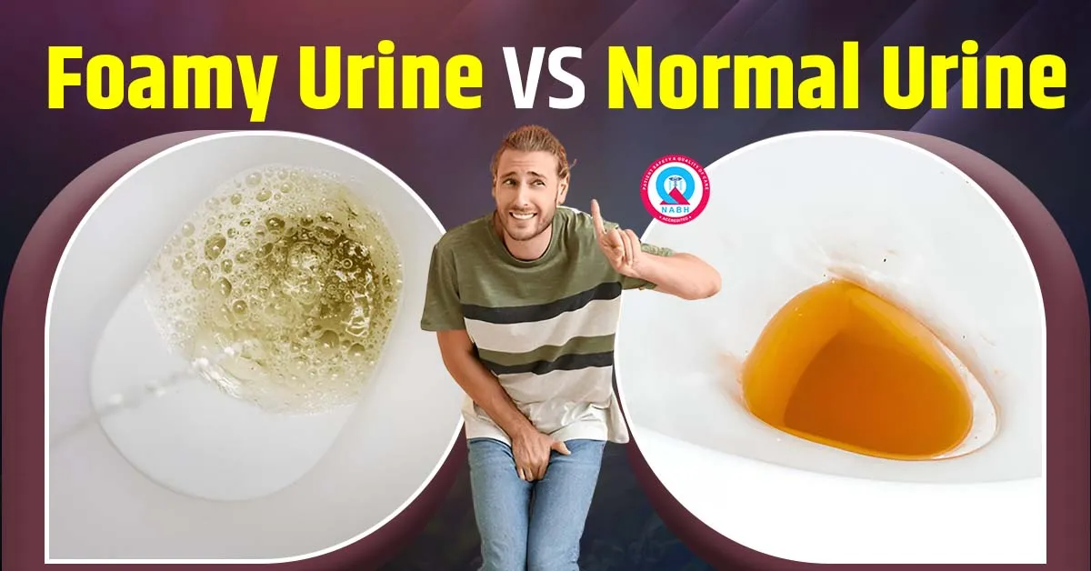 Foamy Urine vs Normal Urine: Know the Signs of Kidney Issues