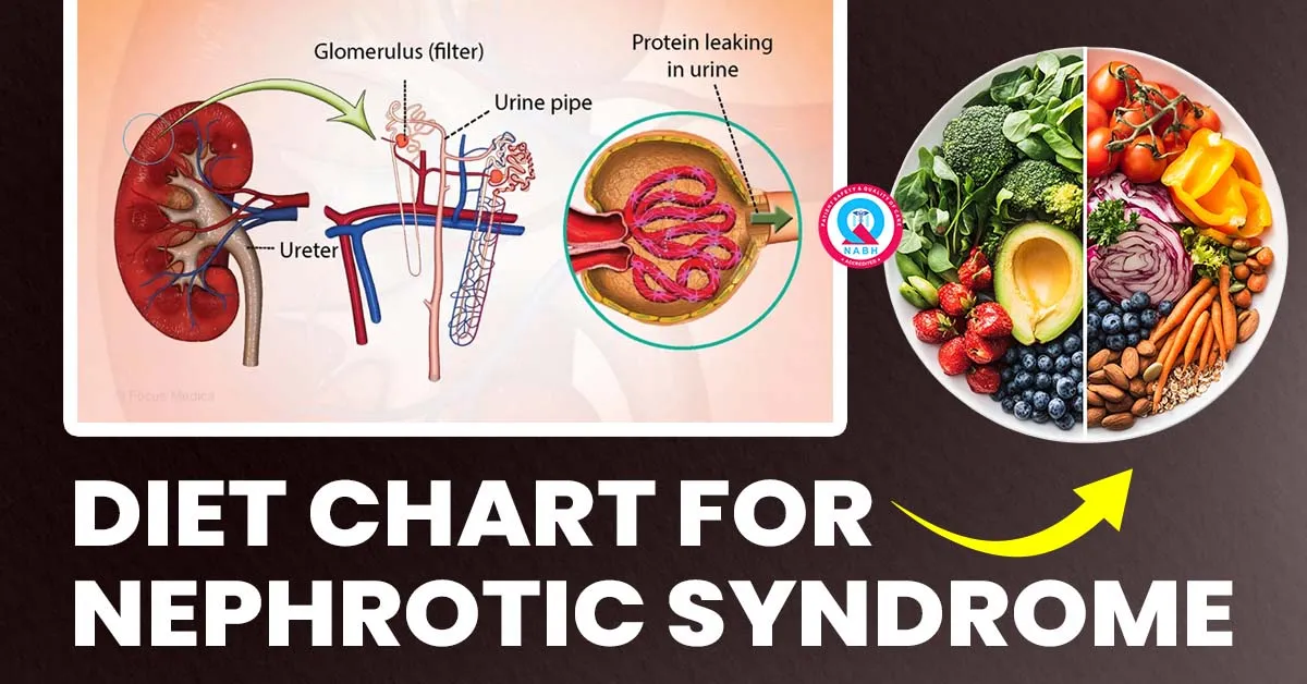 Diet Chart for Nephrotic Syndrome: Eat Smart, Heal Faster (With a Dash ...