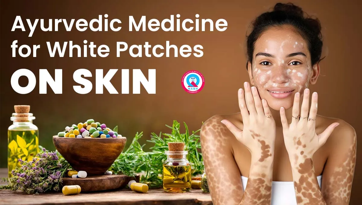 Ayurvedic Medicine for White Patches on Skin: Nature’s Way to Bring ...
