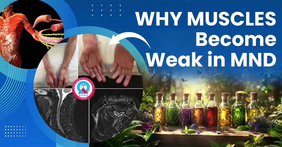 Why Muscles Become Weak in MND (And Why It’s Not Because They’re Lazy)