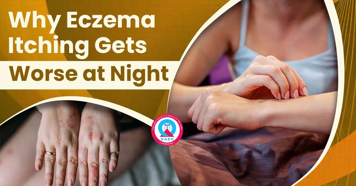 Why Eczema Itching Gets Worse at Night | Causes & Ayurvedic Insight